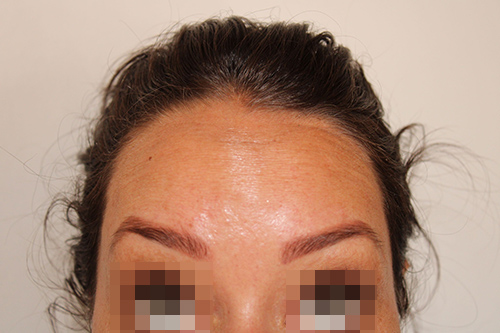 Viscoderm - Enhance Clinispa of Westhoughton | Enhance Clinispa of ...